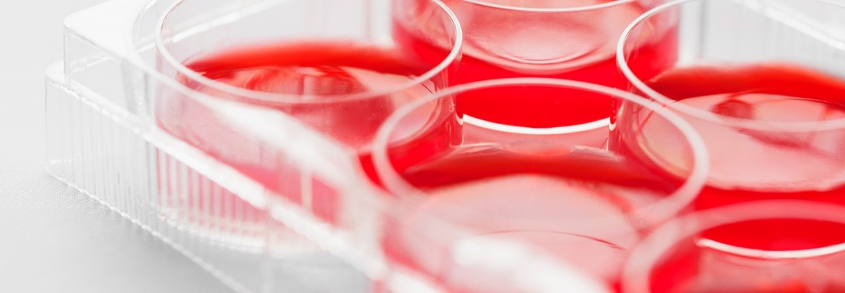 Photocrosslinking of Gelatin (GelMA) and Hyaluronic Acid Hydrogels
